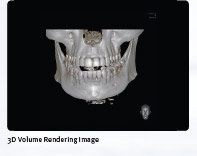 State-of-the-art Digital 3D Radiographic Imaging | Institute of Dental ...